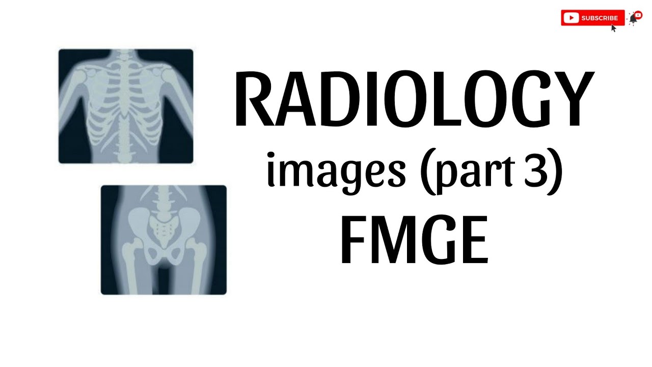 radiology important images for fmge (part 3) #fmge #fmgepreparation # ...