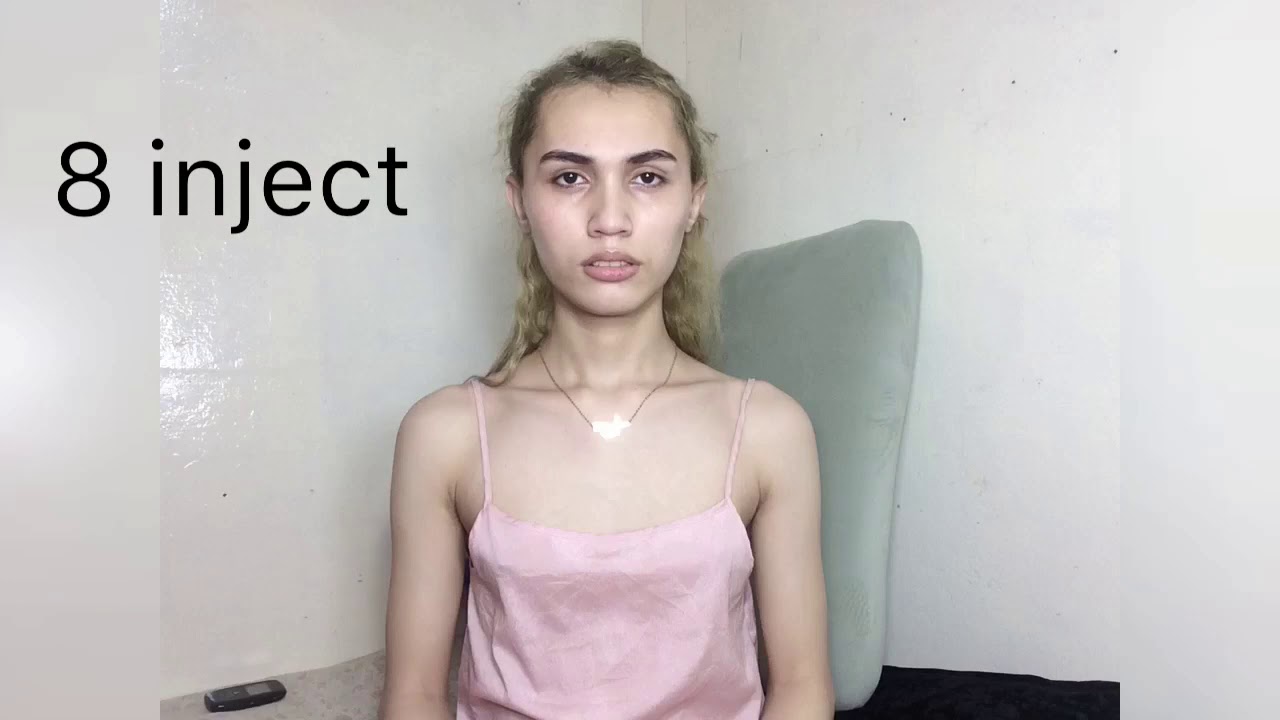 HRT update phenokinon f and Androcur 8 inject - YouTube