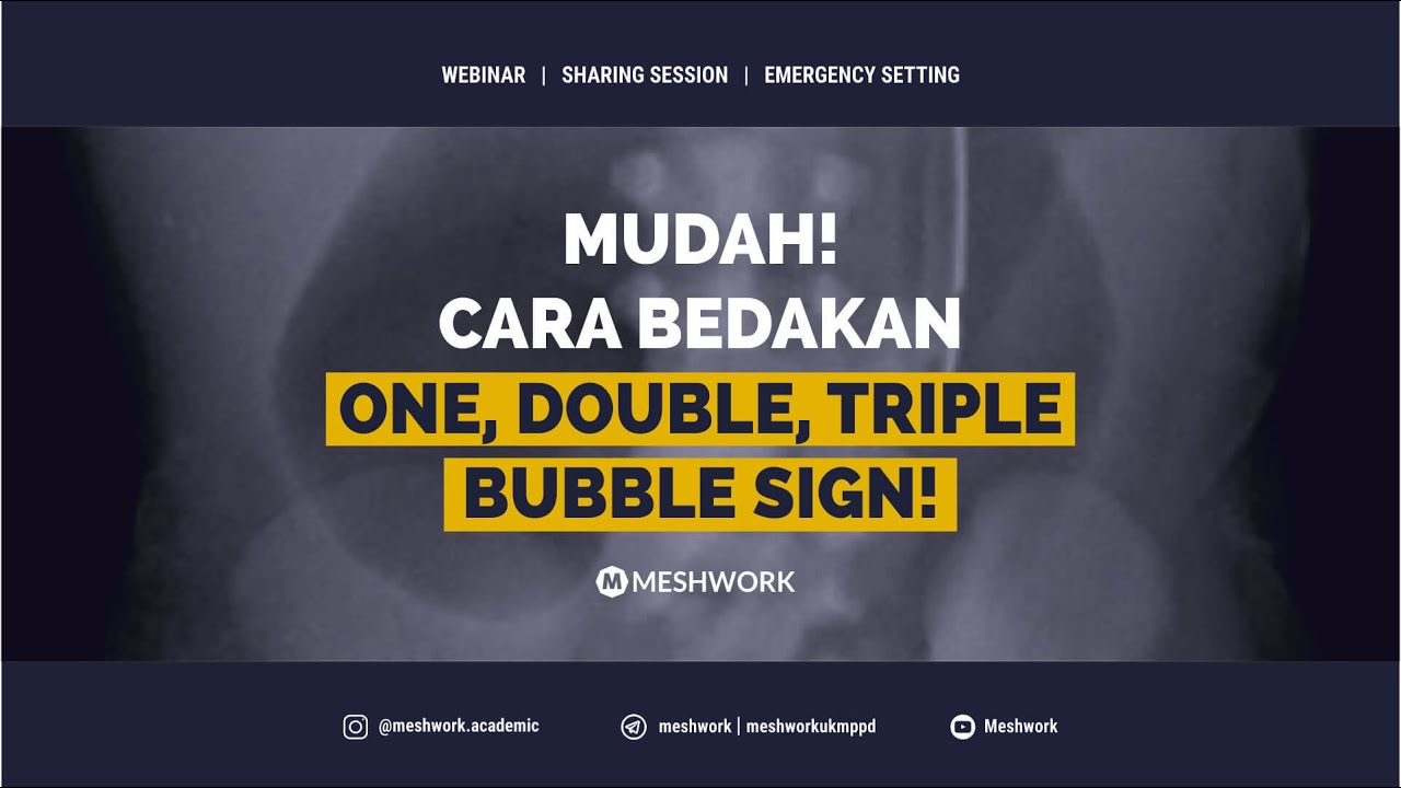 Mudah! Cara bedakan one, double, triple bubble sign ! - YouTube