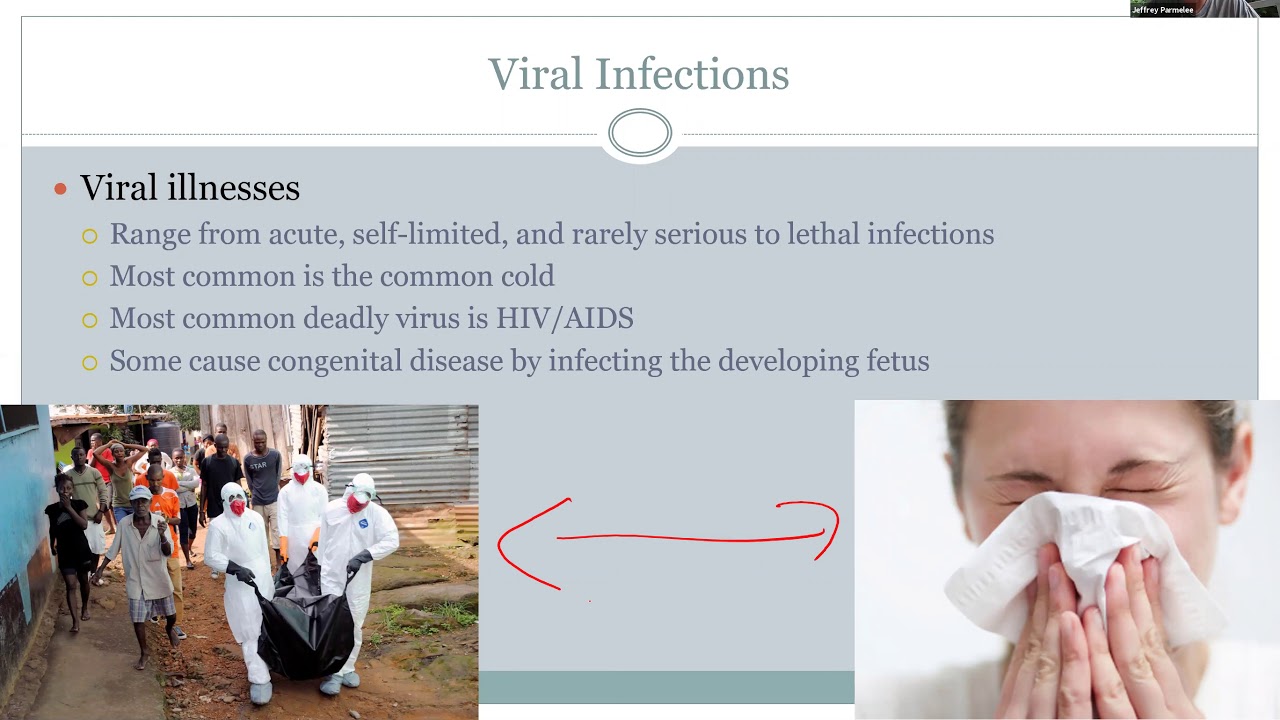 Pathophysiology - Infectious Diseases Part 2 (Chapter 26) - YouTube
