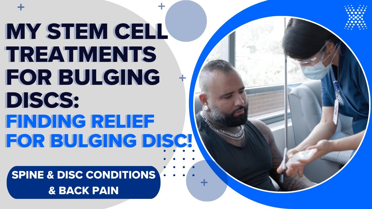 My Journey to Recovery Stem Cell Therapy For Bulging Disc - YouTube