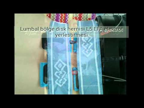 Elektrot yerleştirme