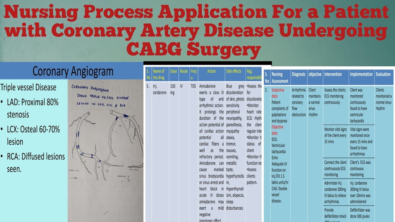 Nursing Process Application for a patient with Coronary Artery Disease ...