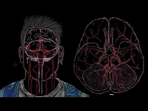 Serebral Kan Akımı (1. Bölüm) (Dolaşım Sistemi Hastalıkları)