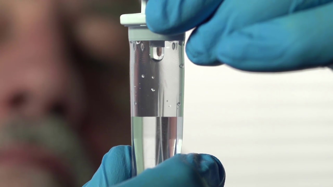 Cos'è il cancro della pelle delle cellule basali - YouTube