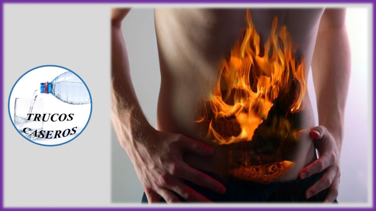 Reflujo acido - Causas sintomas y tratamiento - Remedios naturales para ...