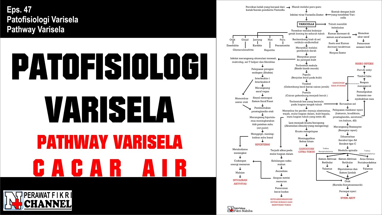 Patofisiologi Varisela I Cacar Air I Chicken Pox (Varicella) I Download ...