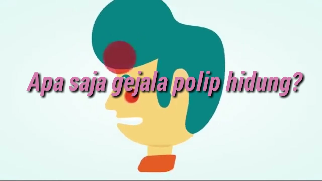 Apa saja gejala polip hidung? - YouTube