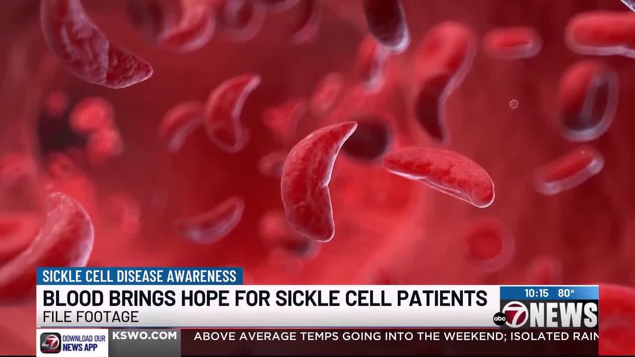 OBI Executive Director Christa Cline Bear speaks on Sickle Cell - YouTube