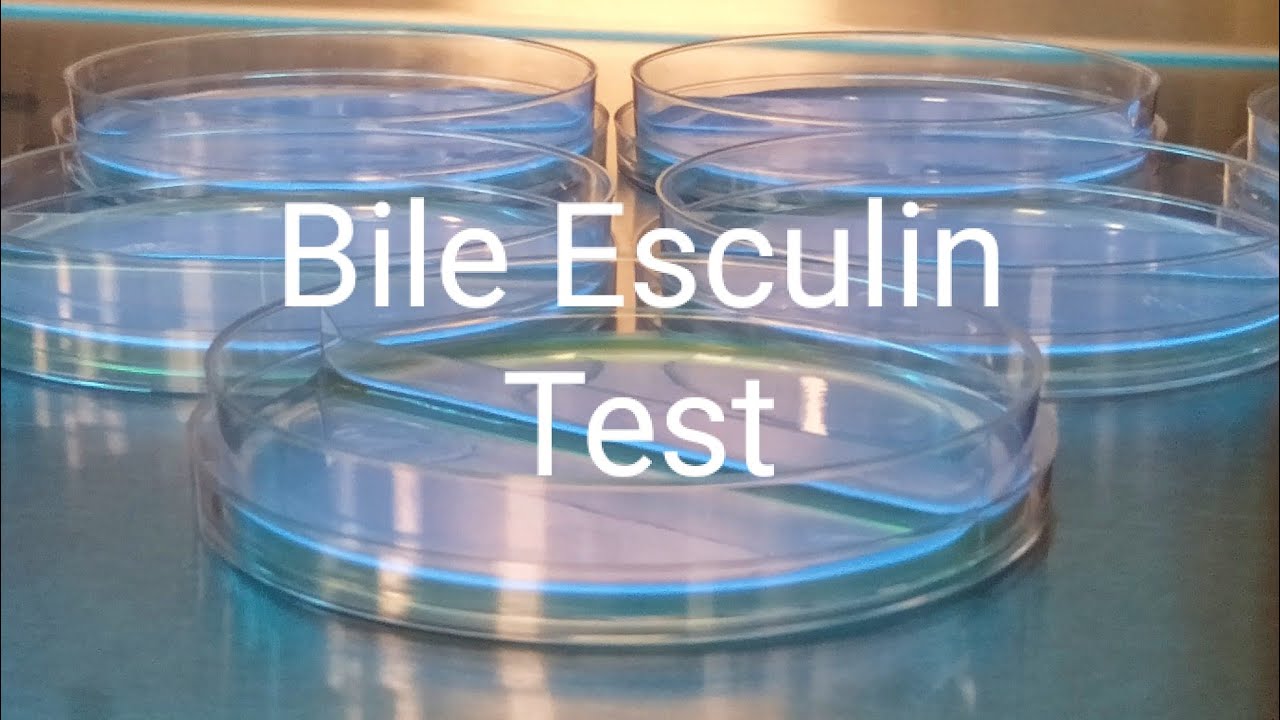 Bile Esculin Test - YouTube