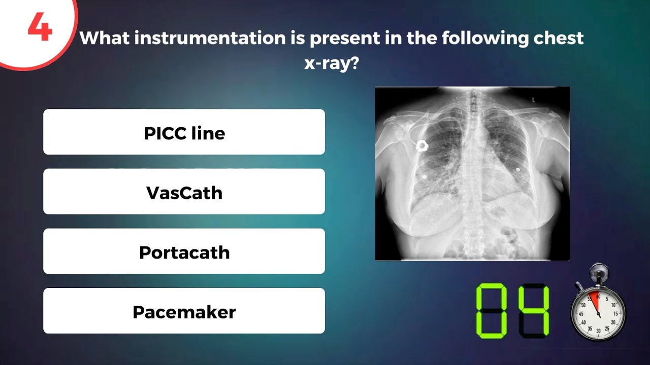 Can You Answer These 30 Medical Questions? Test Your Knowledge! - YouTube
