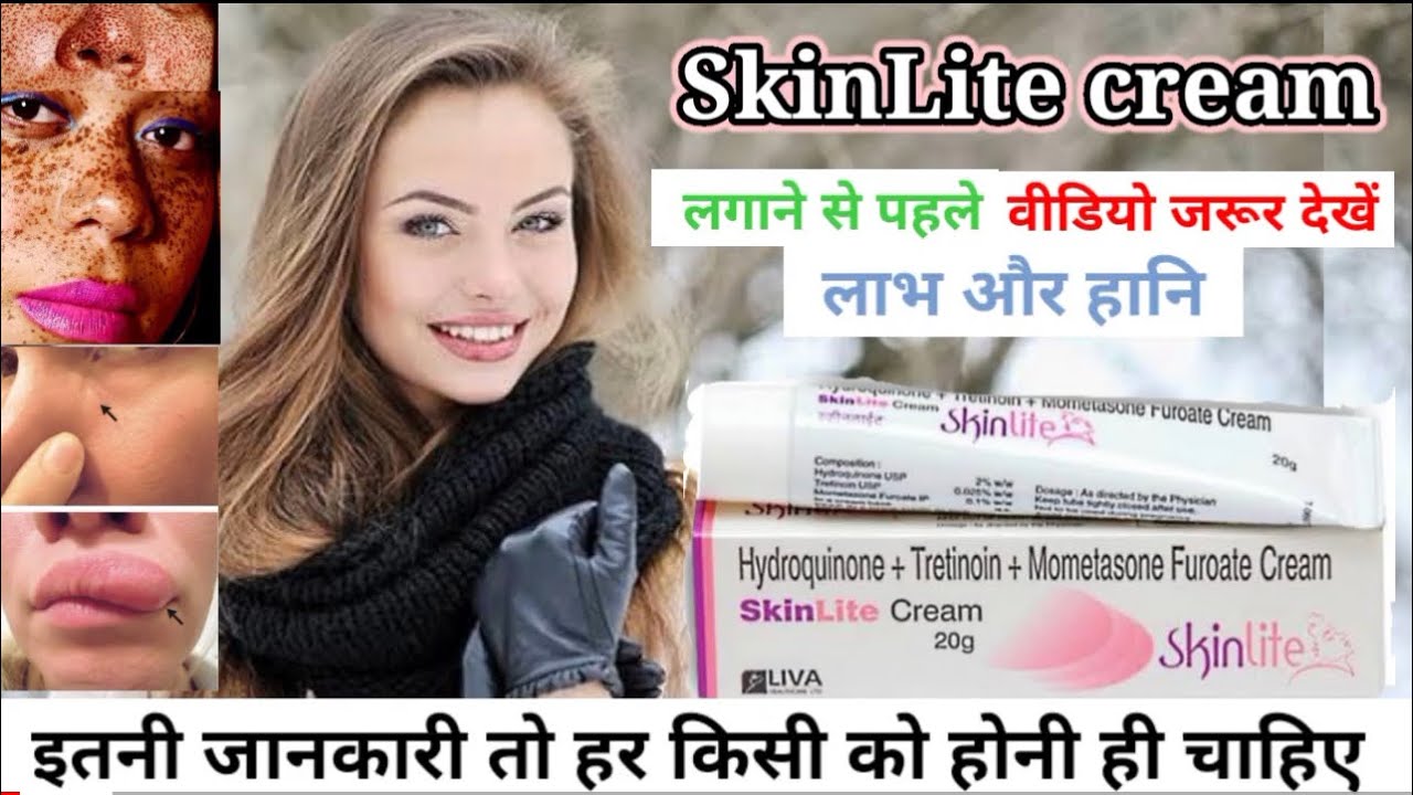 Skinlite cream full review | Skinlite cream side effects | Complete ...