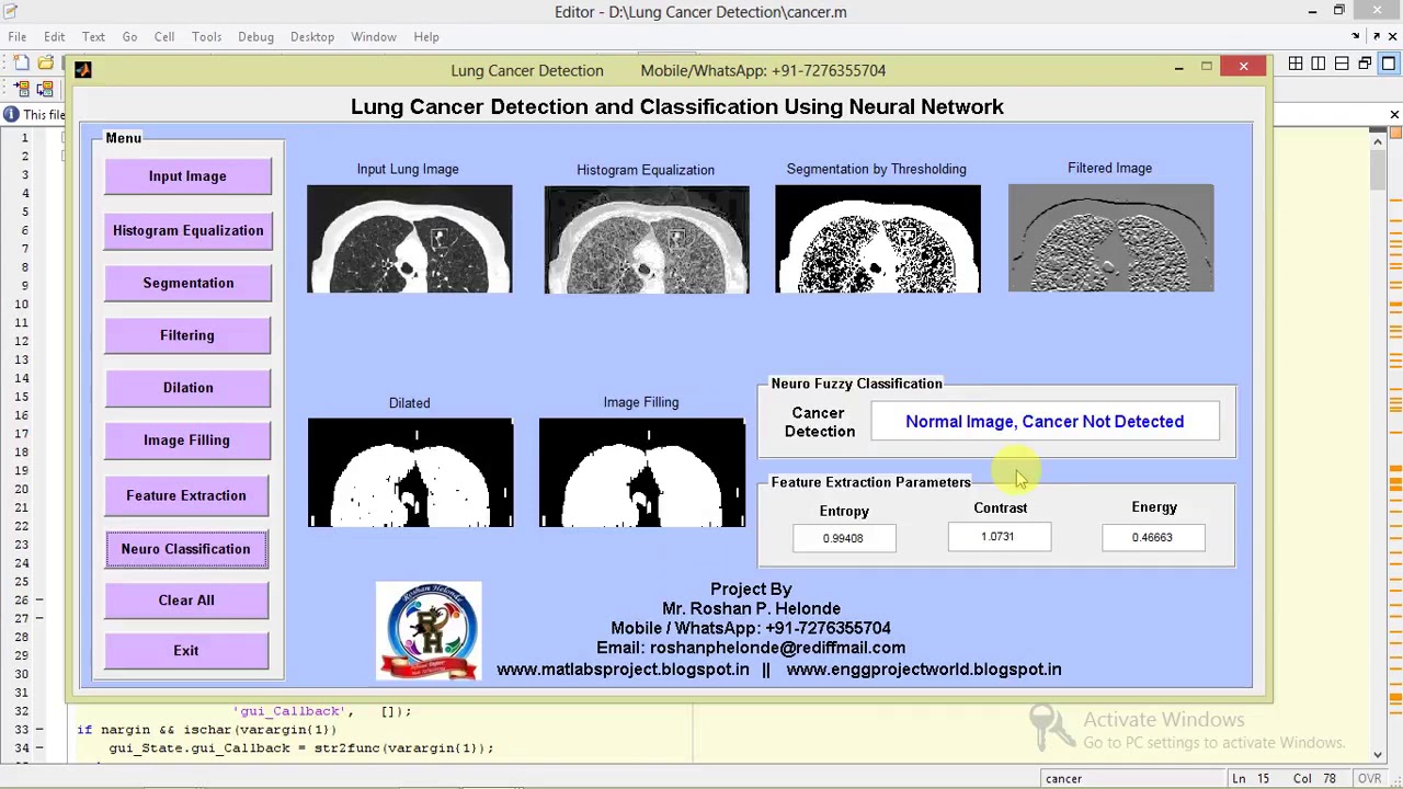Lung Cancer Detection And Classification Using Neural Network Matlab Project Ieee Based Project
