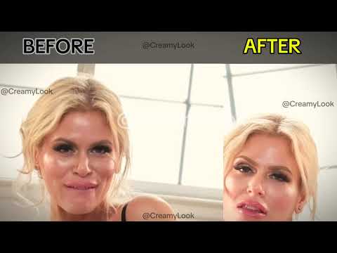 Casca Akashova - The Beautyful Legend V1 Part 2