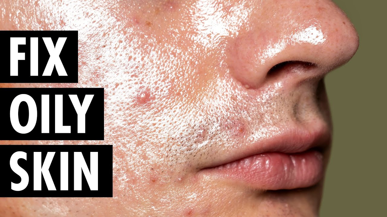 How to Get Rid of Oily Skin | 6 Tips to Cure Oily Skin | Tiege Hanley ...