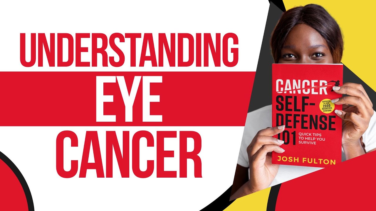 Understanding Eye Cancer: Types, Prognosis, and Treatments - YouTube