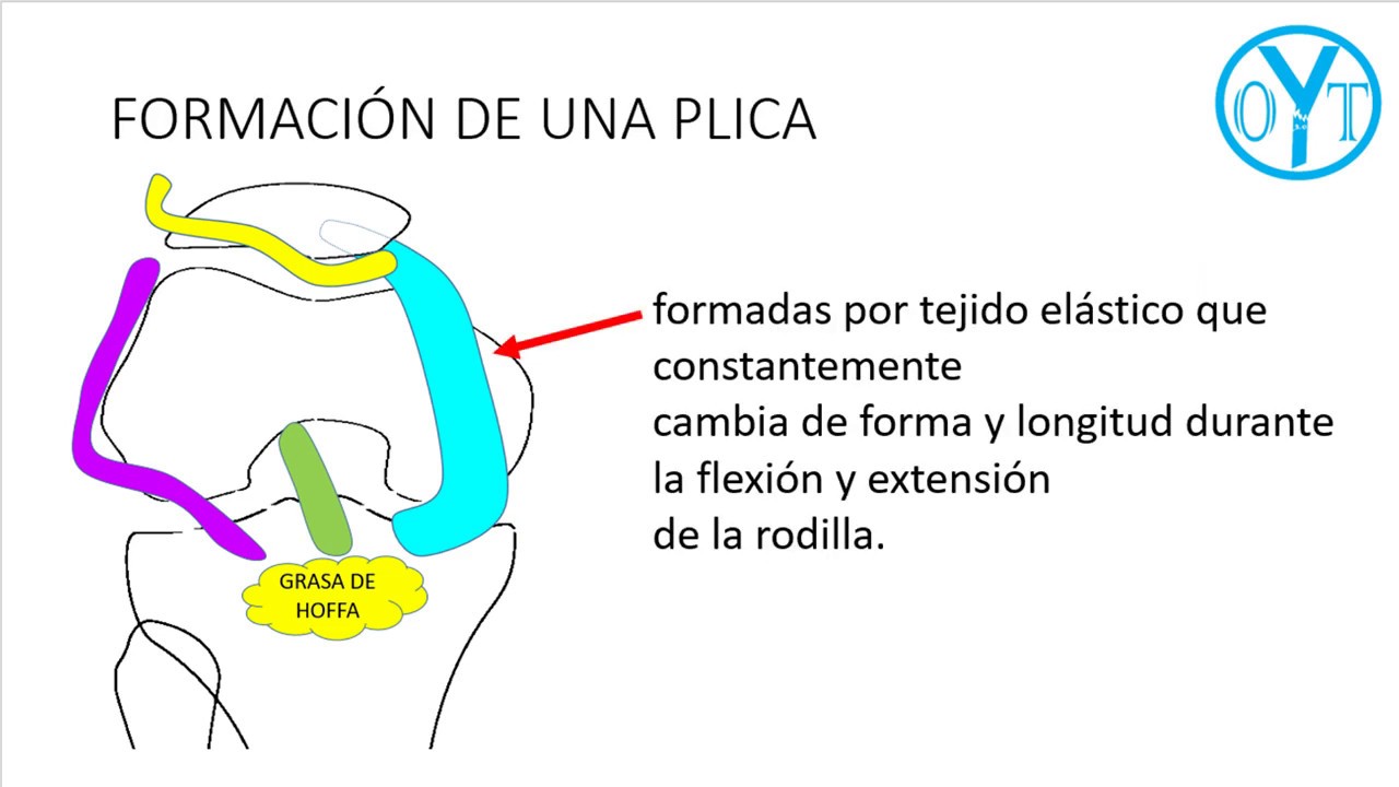 síndrome doloroso de la plica medial, mecanismo de acción - YouTube
