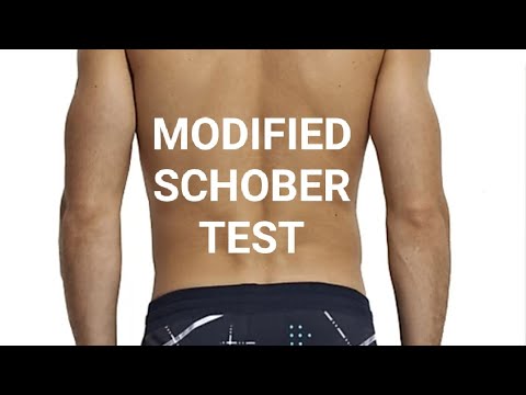 MODIFIED SCHOBER'S TEST - YouTube