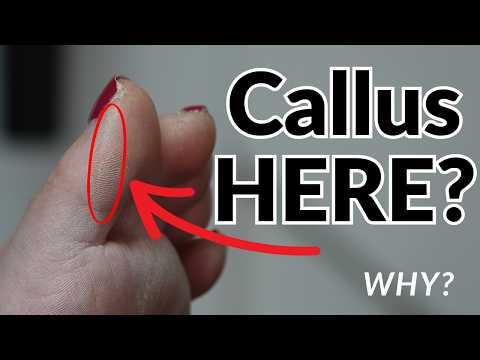 Callus of the Big Toe