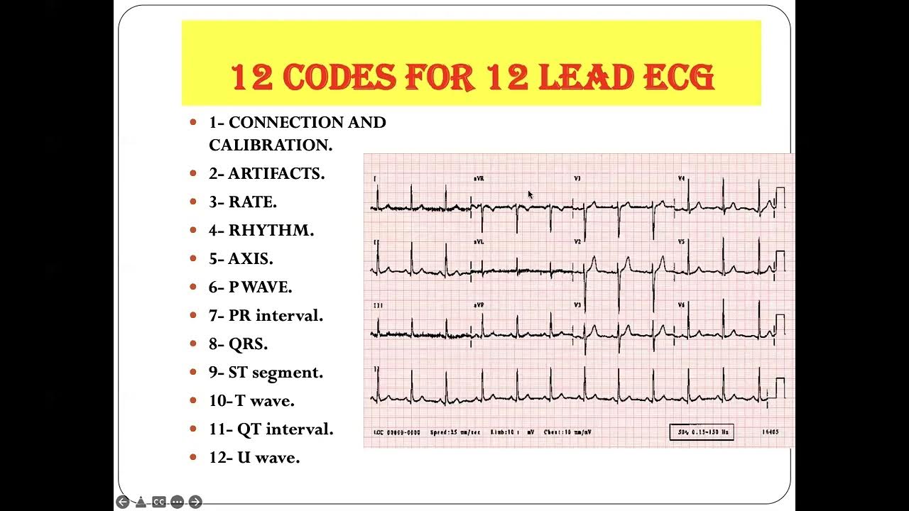 ECG secret codes: video 20: ECG interpretation, CODE 12, U wave - YouTube
