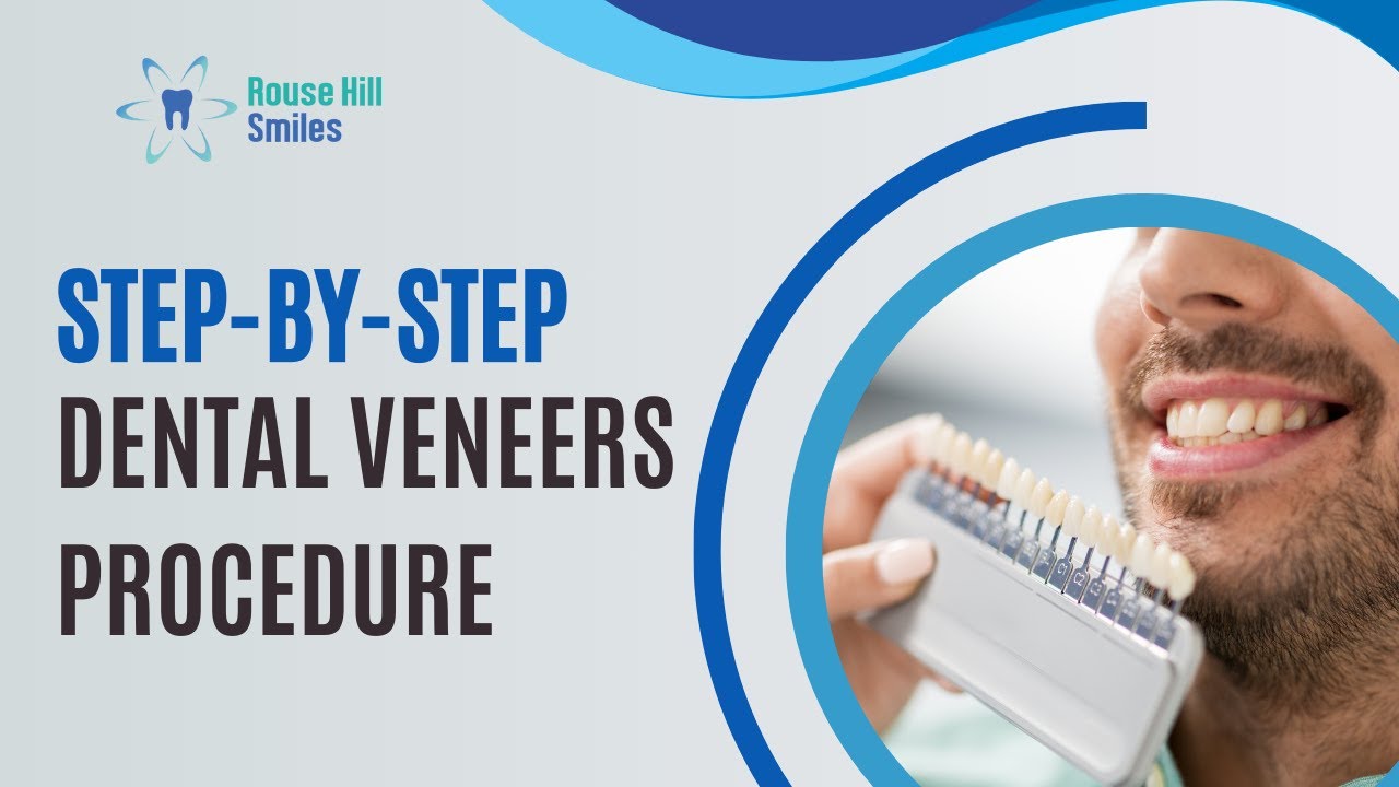 Step-by-Step Dental Veneers Procedure - YouTube