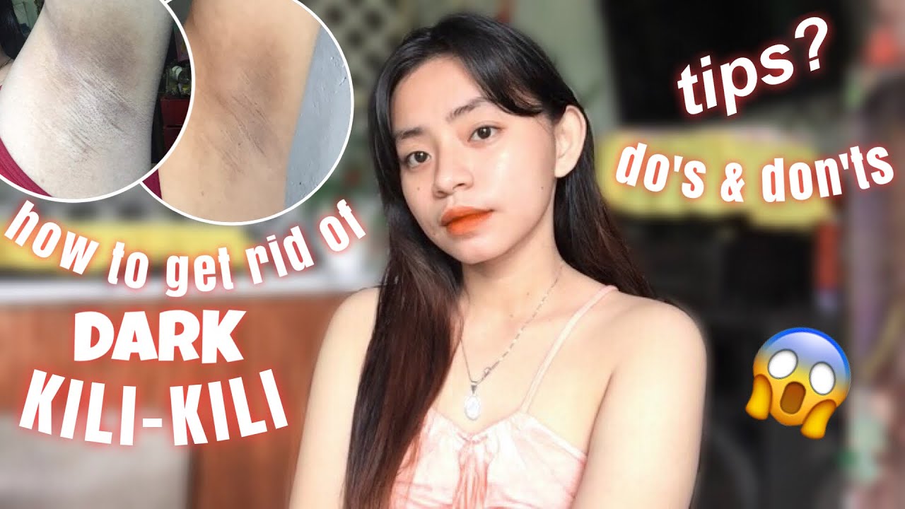 HOW TO GET RID OF DARK KILI-KILI + TIPS ~ (DO's & DON'Ts) - YouTube