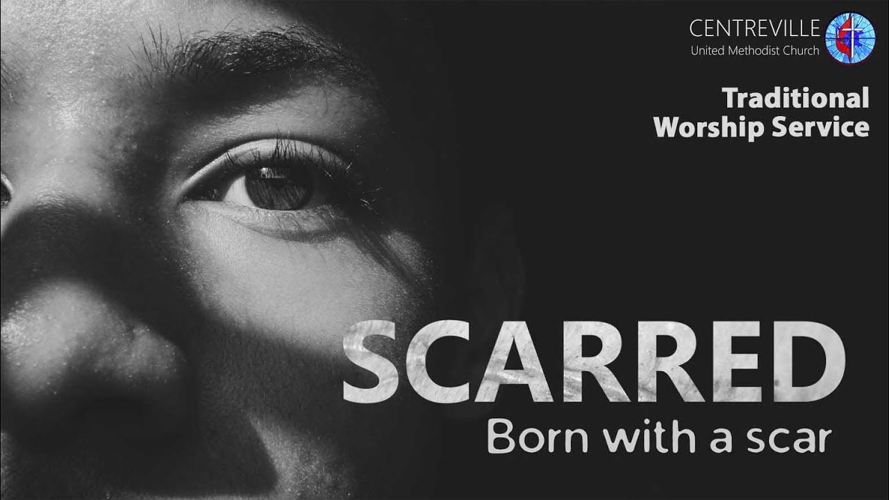 "Born with a Scar" | Centreville United Methodist Church - YouTube
