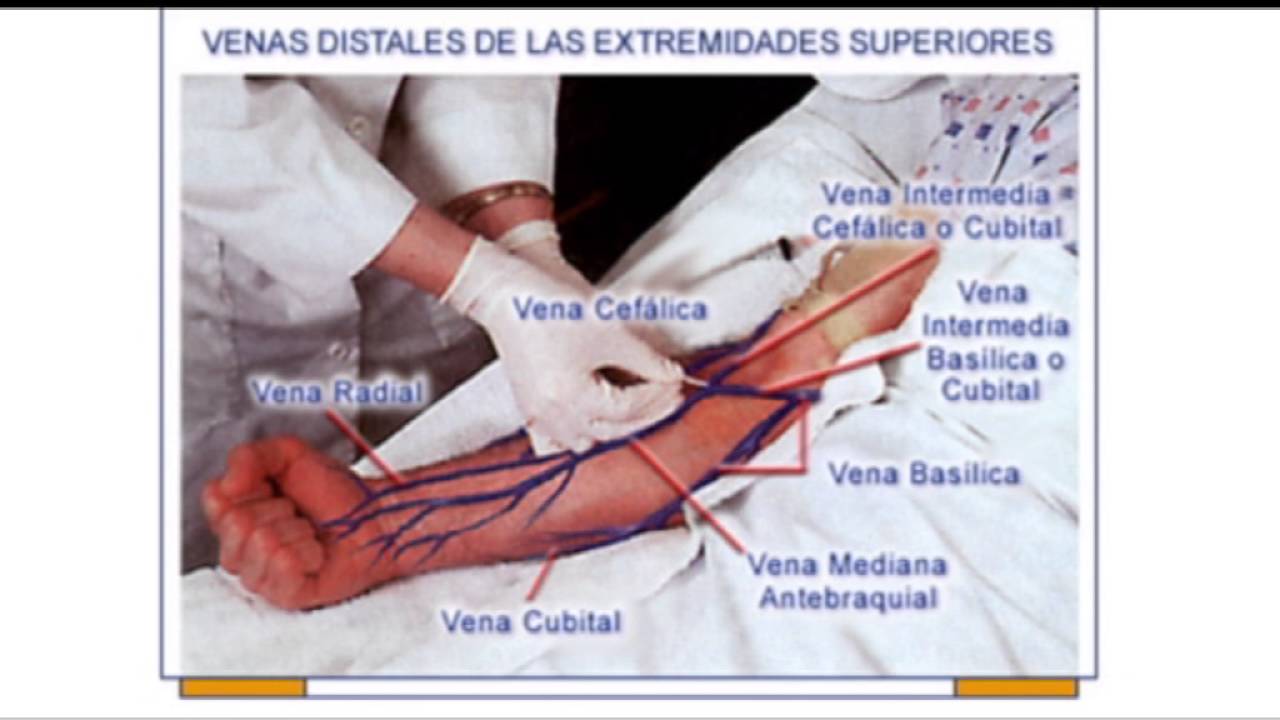 Acceso venoso - YouTube