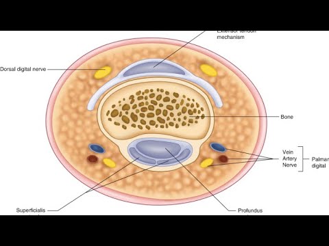 Digital nerve block of the great toe - YouTube