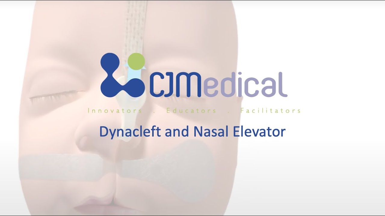 DynaCleft and Nasal Elevator System - YouTube