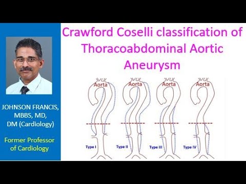 Thoracic Aortic Aneurysm Classification