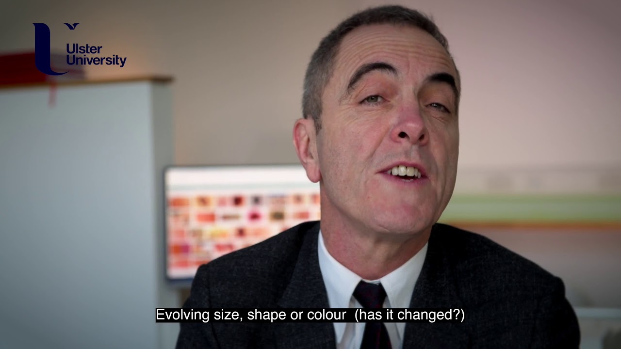Ulster University Skin Cancer Research - YouTube