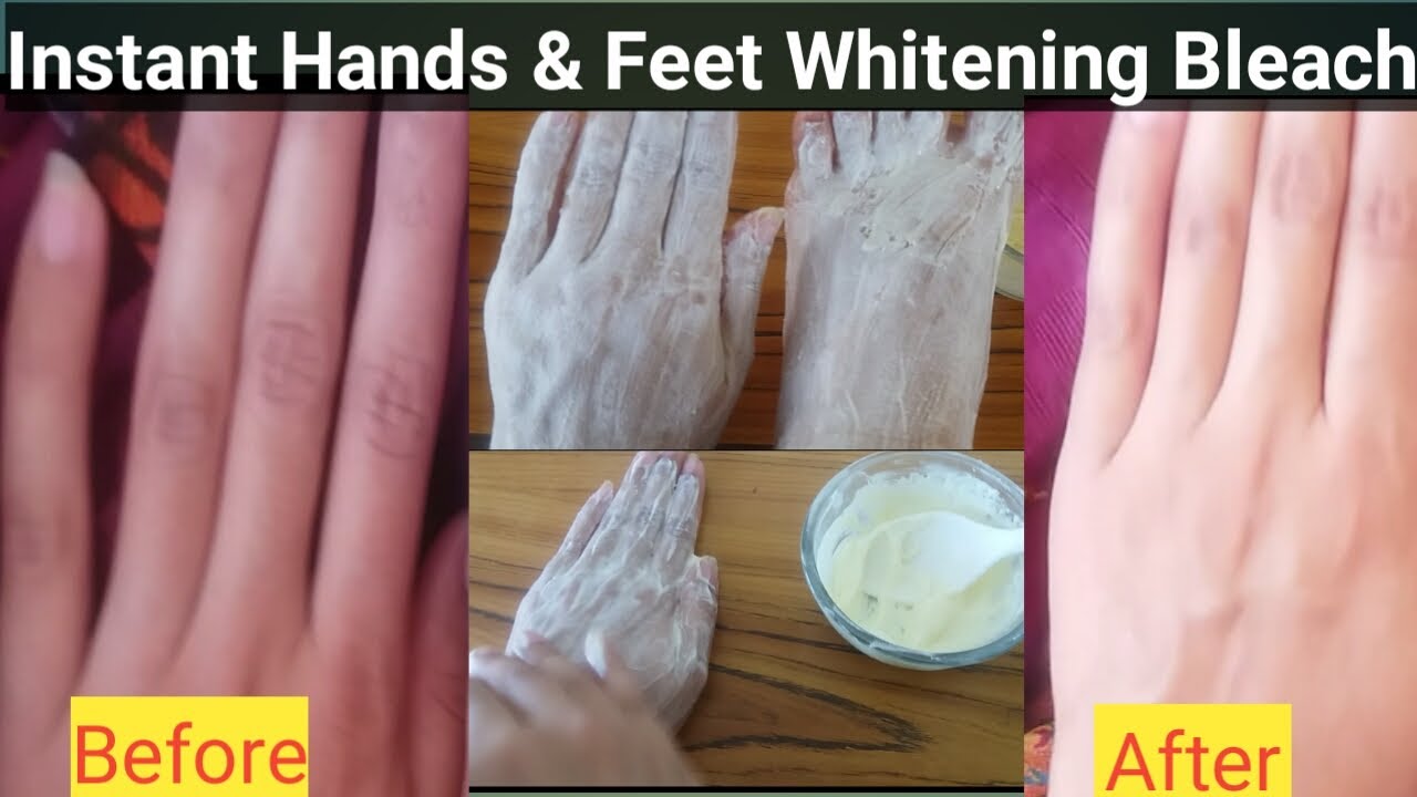 How To Whiten Your Hands/Feet In 15 minutes|| Instant Hand & Feet ...