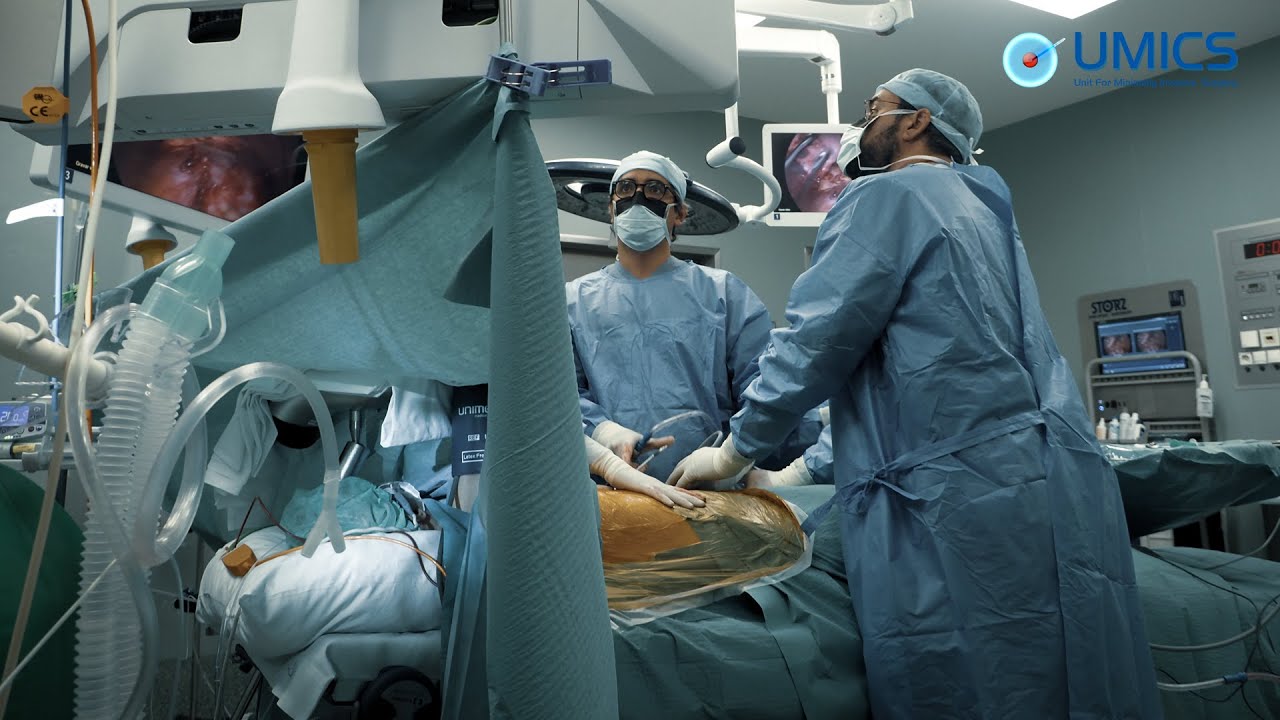 Subxiphoid NON Intubated Lobectomy Uniportal VATS Surgery - YouTube