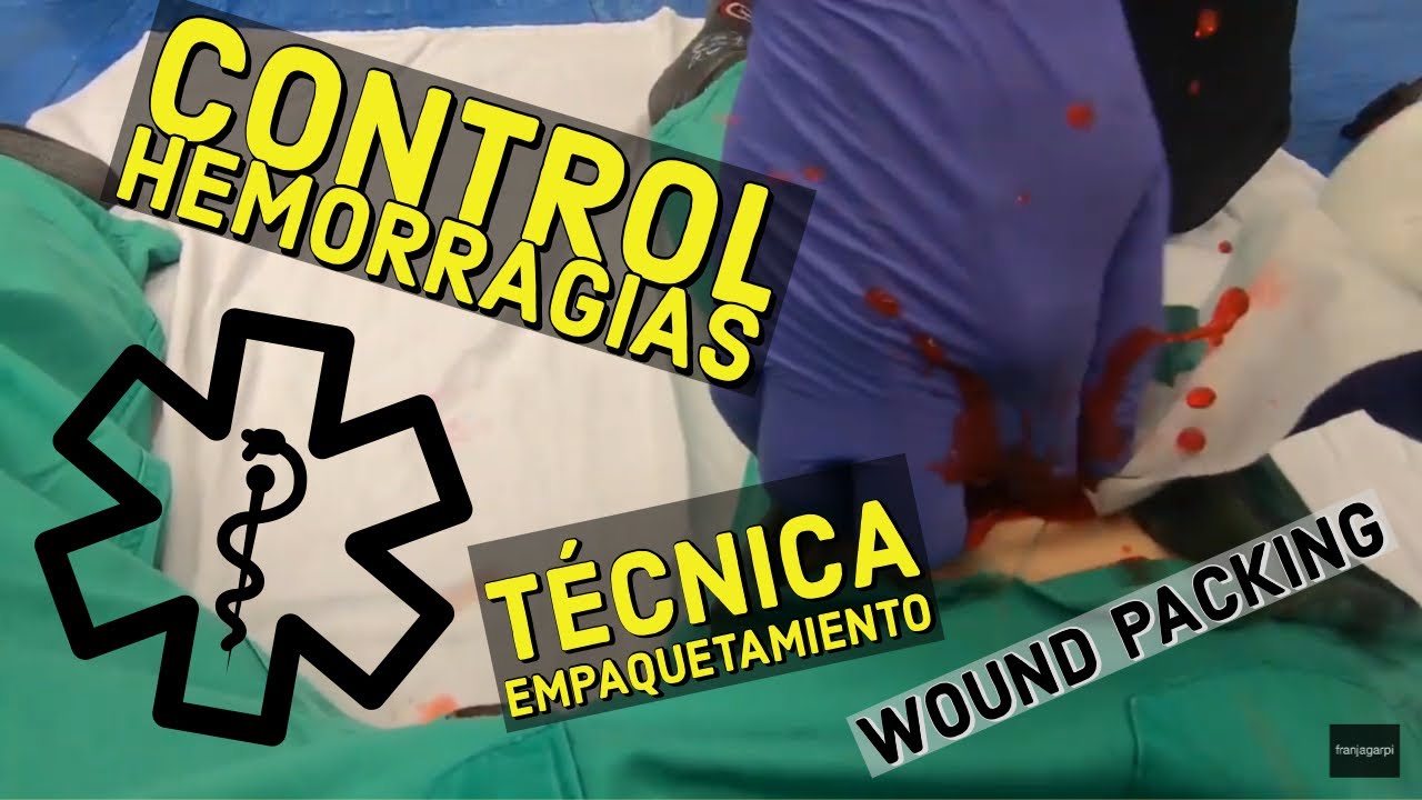 CONTROL DE HEMORRAGIAS / TÉCNICA EMPAQUETAMIENTO / WOUND PACKING - YouTube