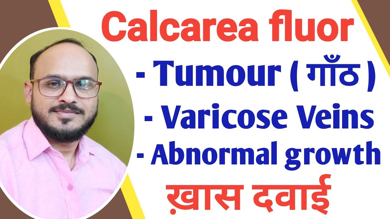 Calcarea Flour explained | Dose and symptoms | Brain tumour | varicose ...