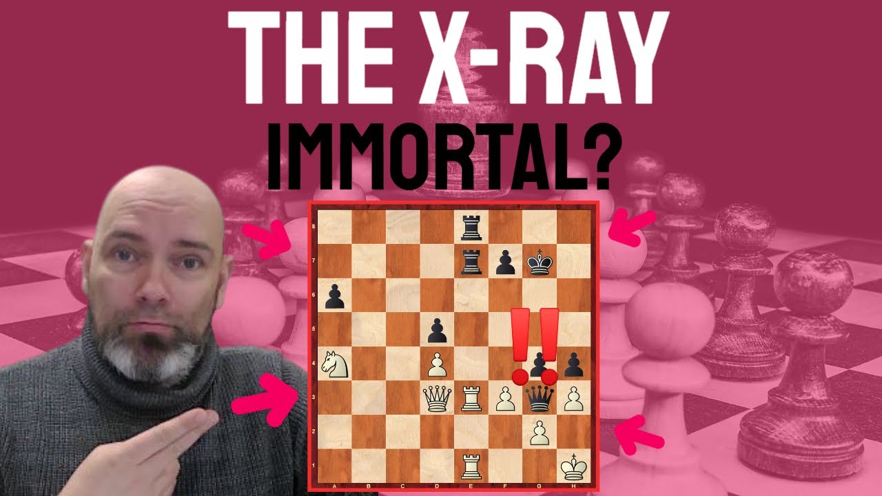 The immortal X-Ray Game? Legendary missed tactics at the Icelandic ...
