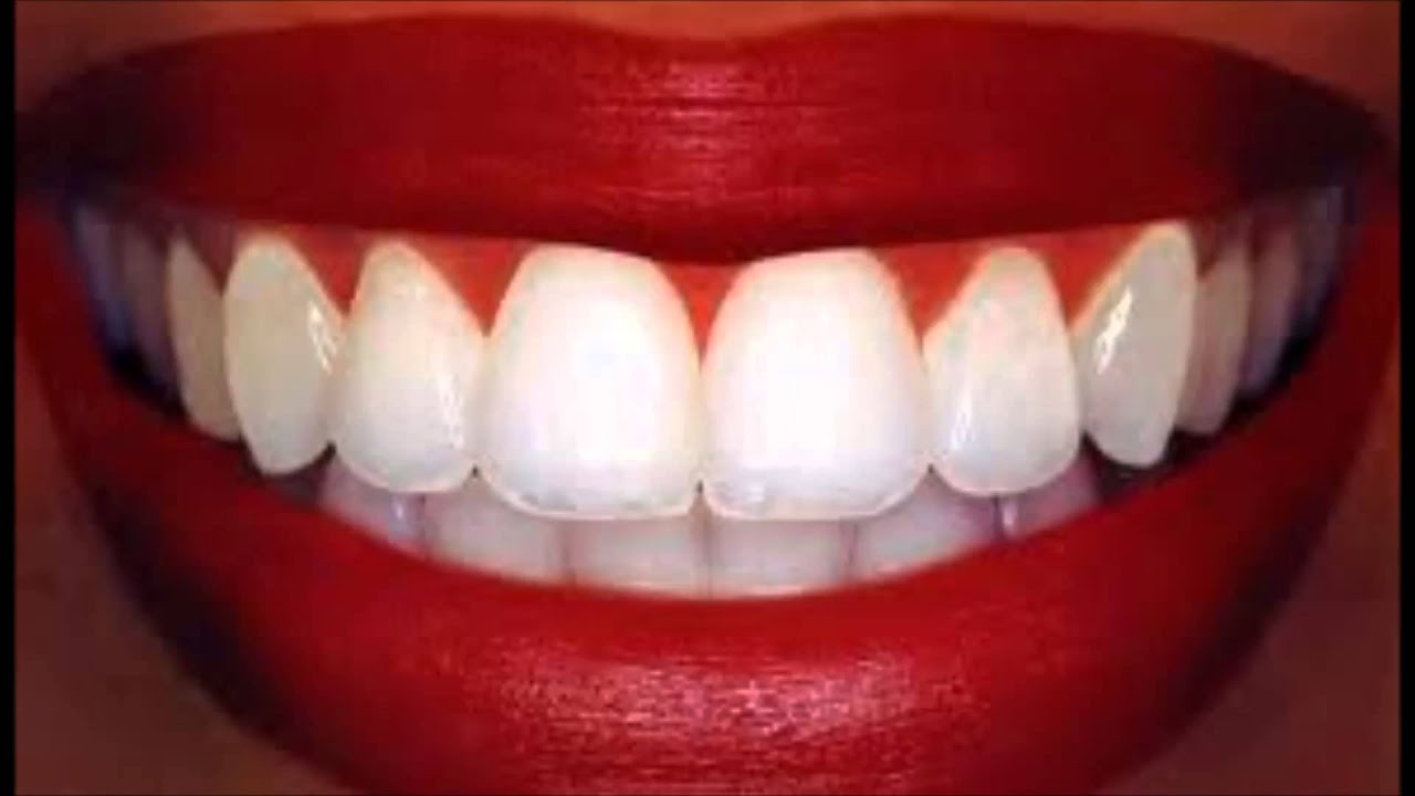 Santah - Teeth - YouTube
