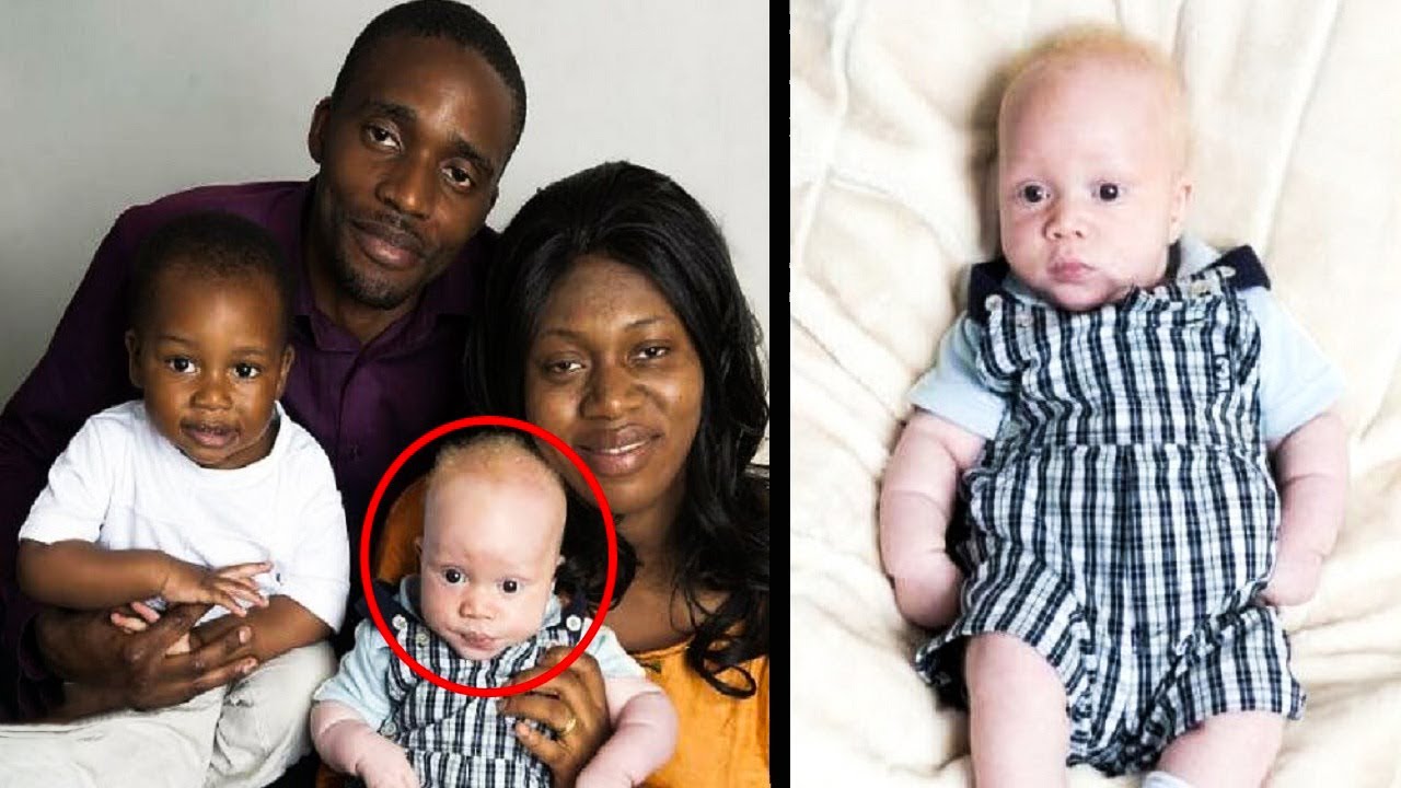 This Black Nigerian Couple Have Somehow Given Birth To A White Baby ...