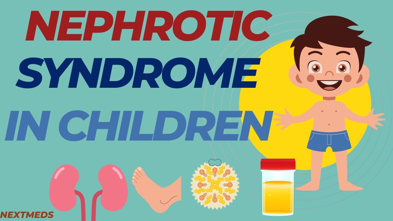 Nephrotic Syndrome In Children|Causes|Signs And Symptoms|Diagnosis ...
