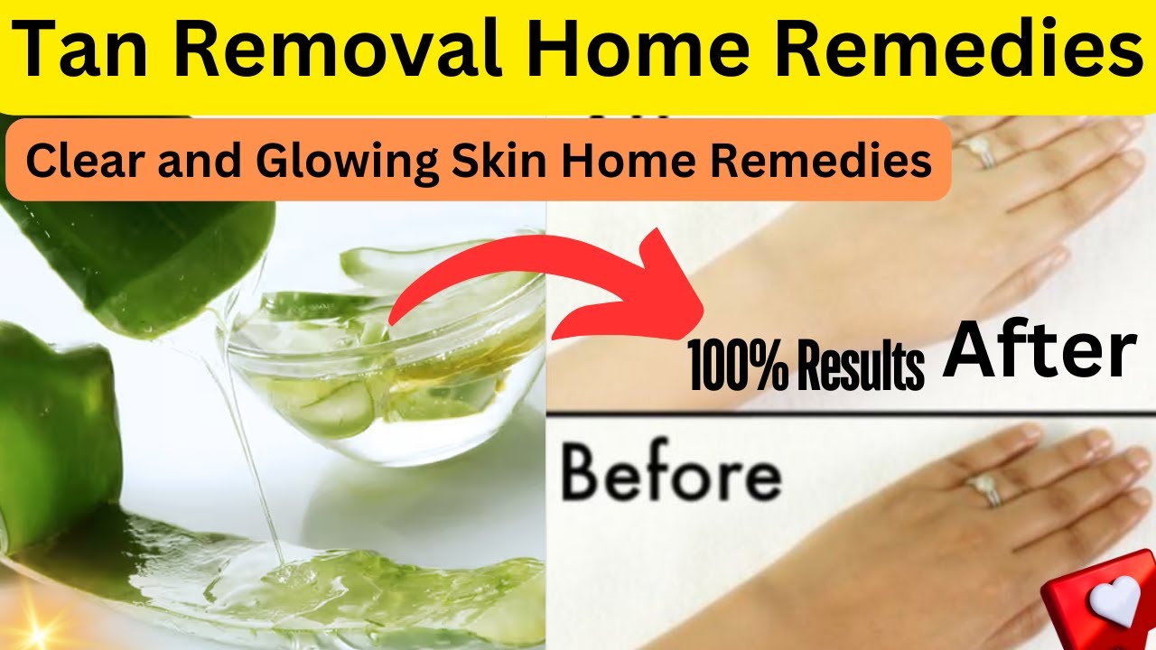 Clear and Glowing Skin Home Remedies | Tan Removal Home Remedy | Tan ...