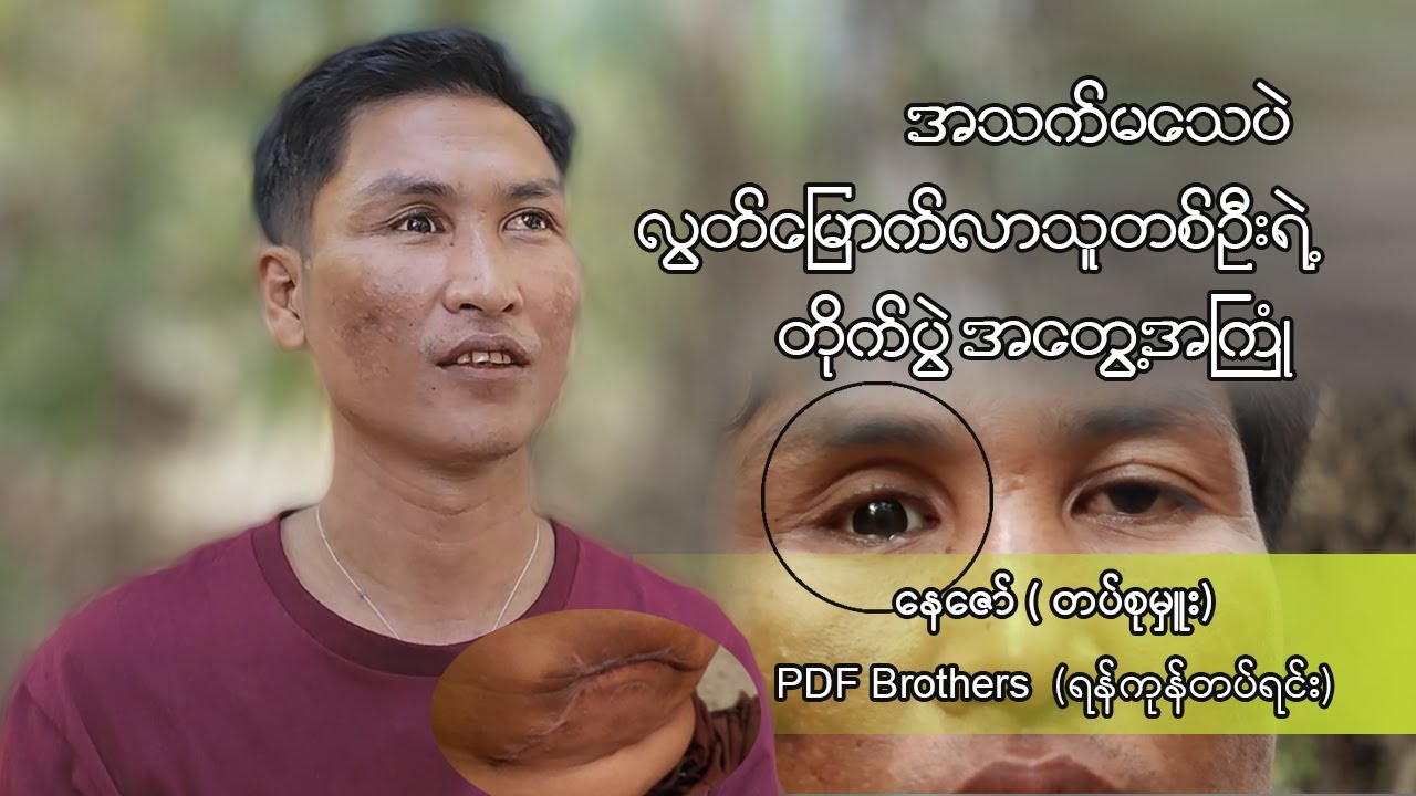 Tlt Tv အသက်အသေပဲ လွတ်မြောက်လာသူတစ်ဦးရဲ့ တိုက်ပွဲ အတွေ့အကြုံများ