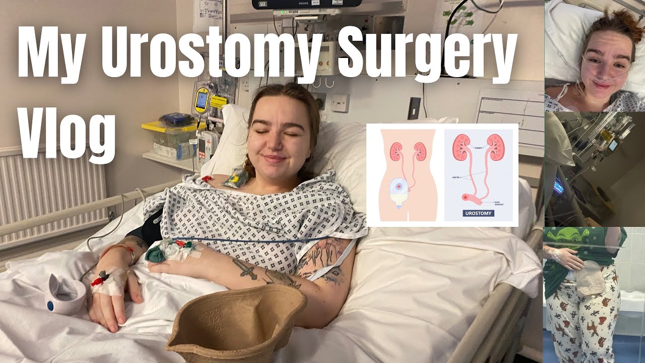 I had my bladder removed? Urostomy Surgery Vlog | Lead up, ICU stay ...