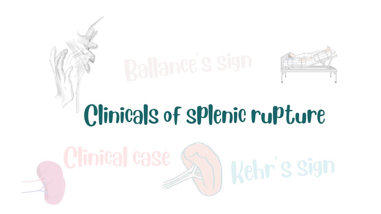 Clinicals of splenic rupture|| Kehr’s sign | Ballance’s sign | clinical case | Dr.Q - YouTube