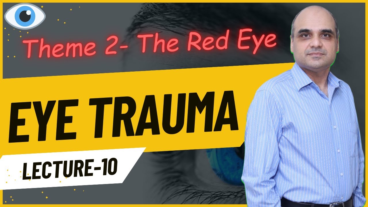 Eye Trauma Lecture 10 - YouTube