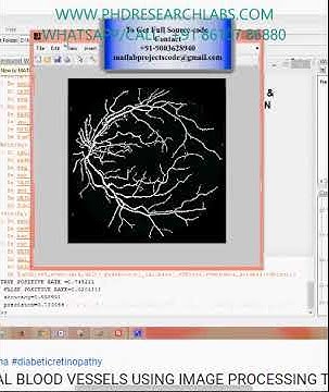 ANALYSIS OF RETINAL BLOOD VESSELS USING IMAGE PROCESSING TECHNIQUES -MATLAB ASSIGNMENTS PROJECTS ...