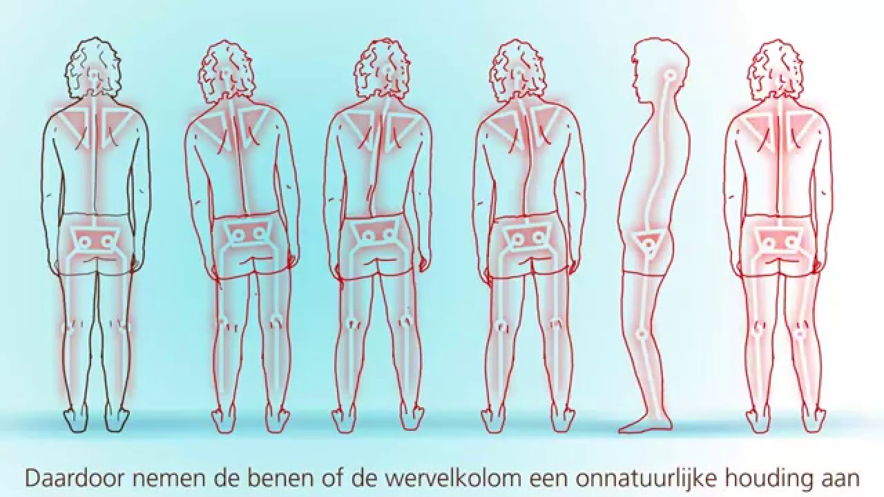 Rug en nekpijn door een bekkenscheefstand - YouTube
