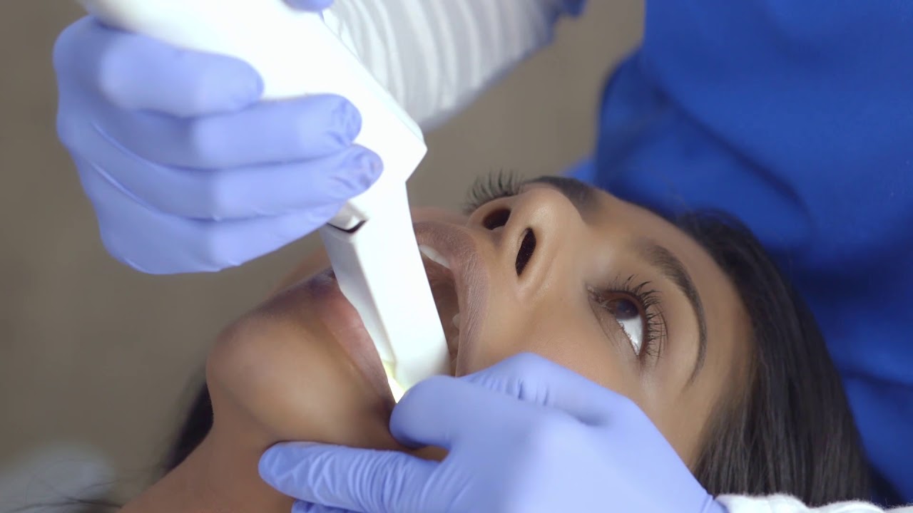 iTero Element - YouTube