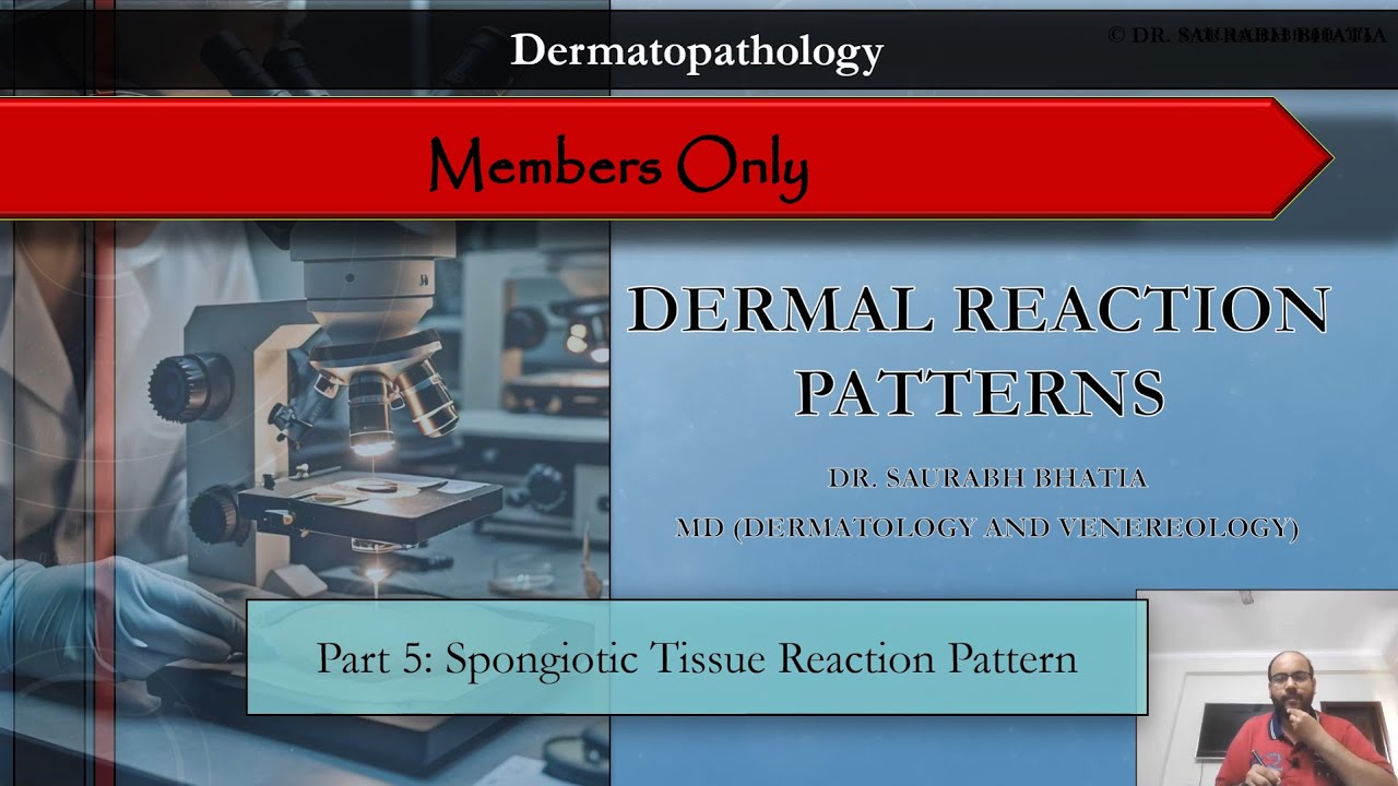 [Members Only] Dermatopathology - V - Spongiotic Tissue Reaction ...