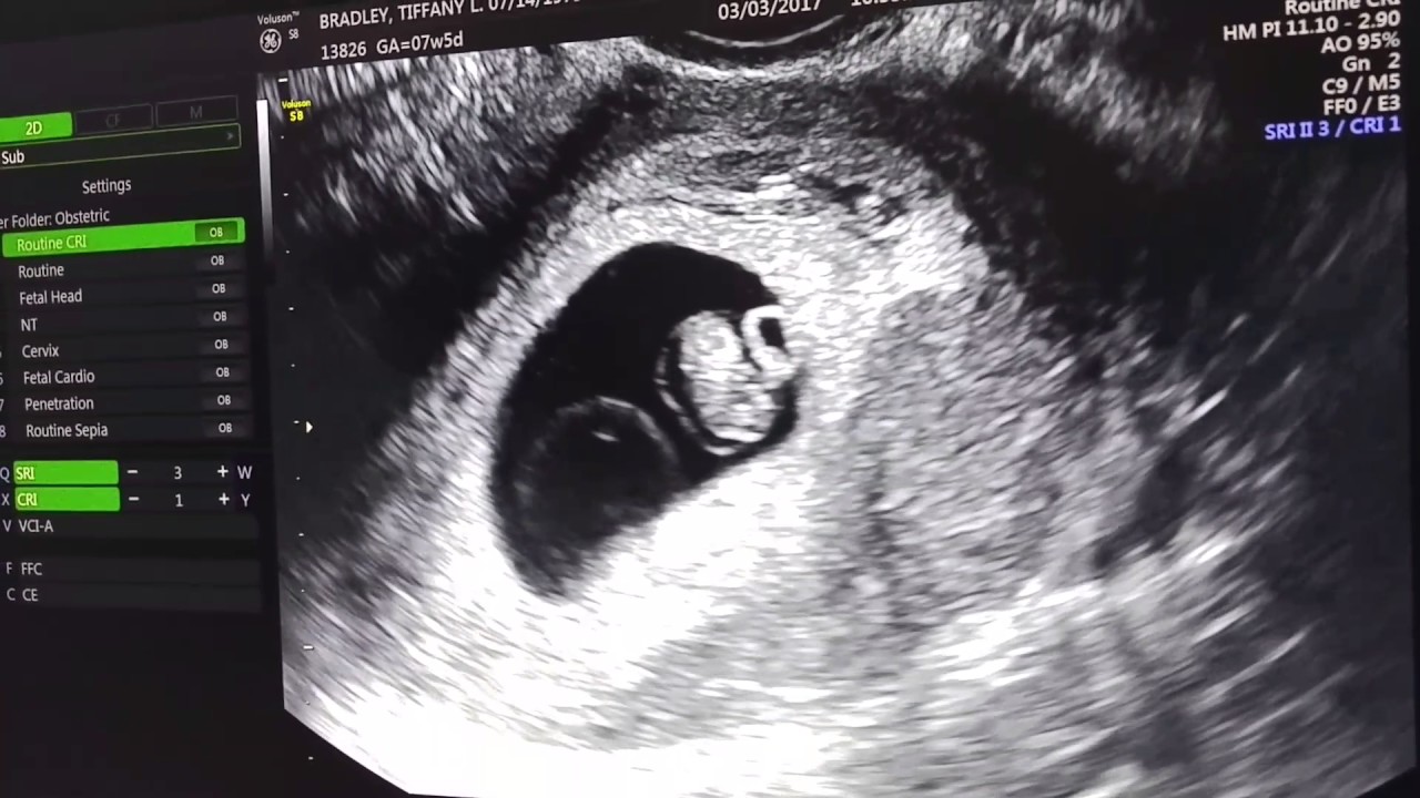 7 Weeks 5 Days YouTube 7-weeks-5-days-youtube